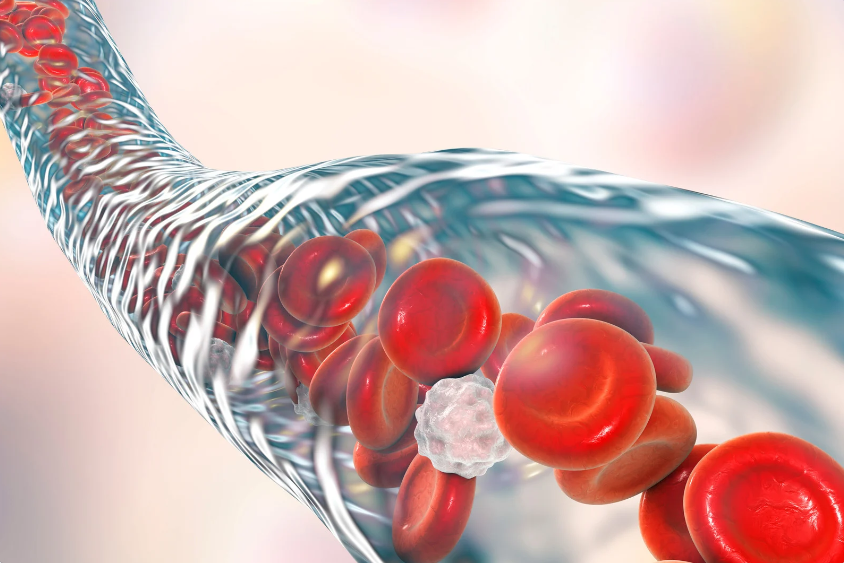 Heat vs. Cold: Optimal Therapy for Pain Relief - Newcastle Physio